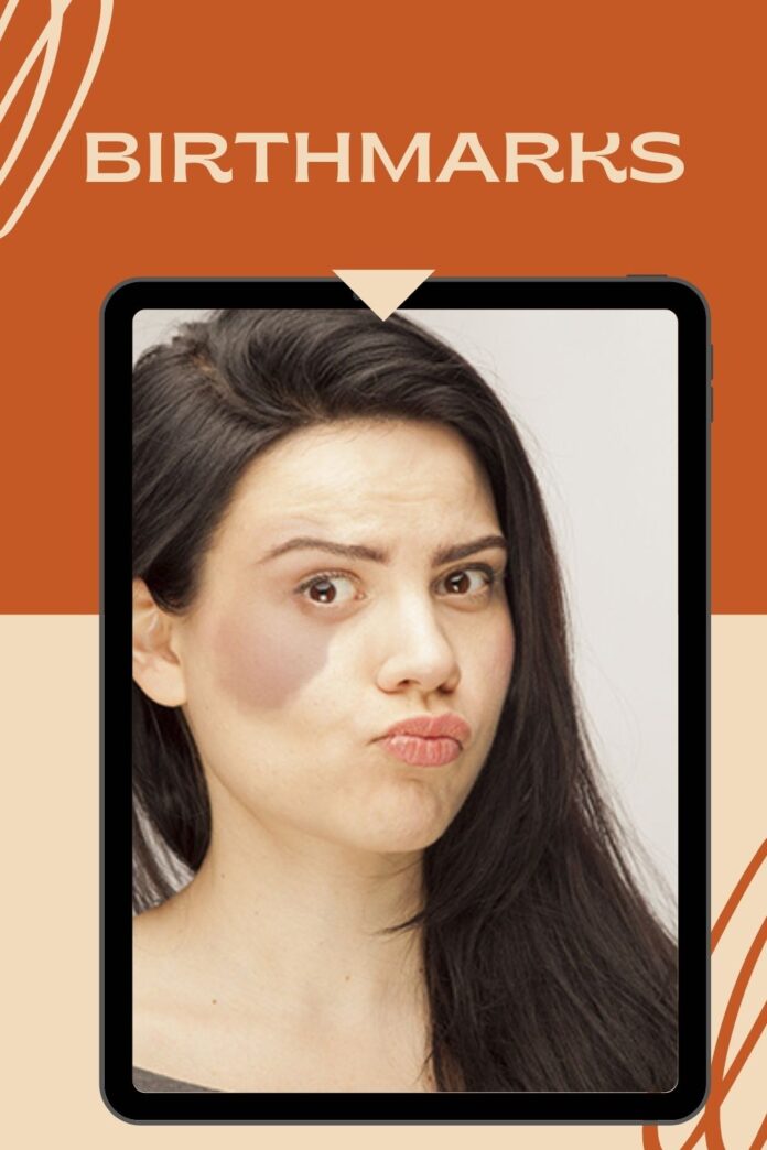 Skin Blemishes: Types And Ways To Remove Skin Blemishes Naturally