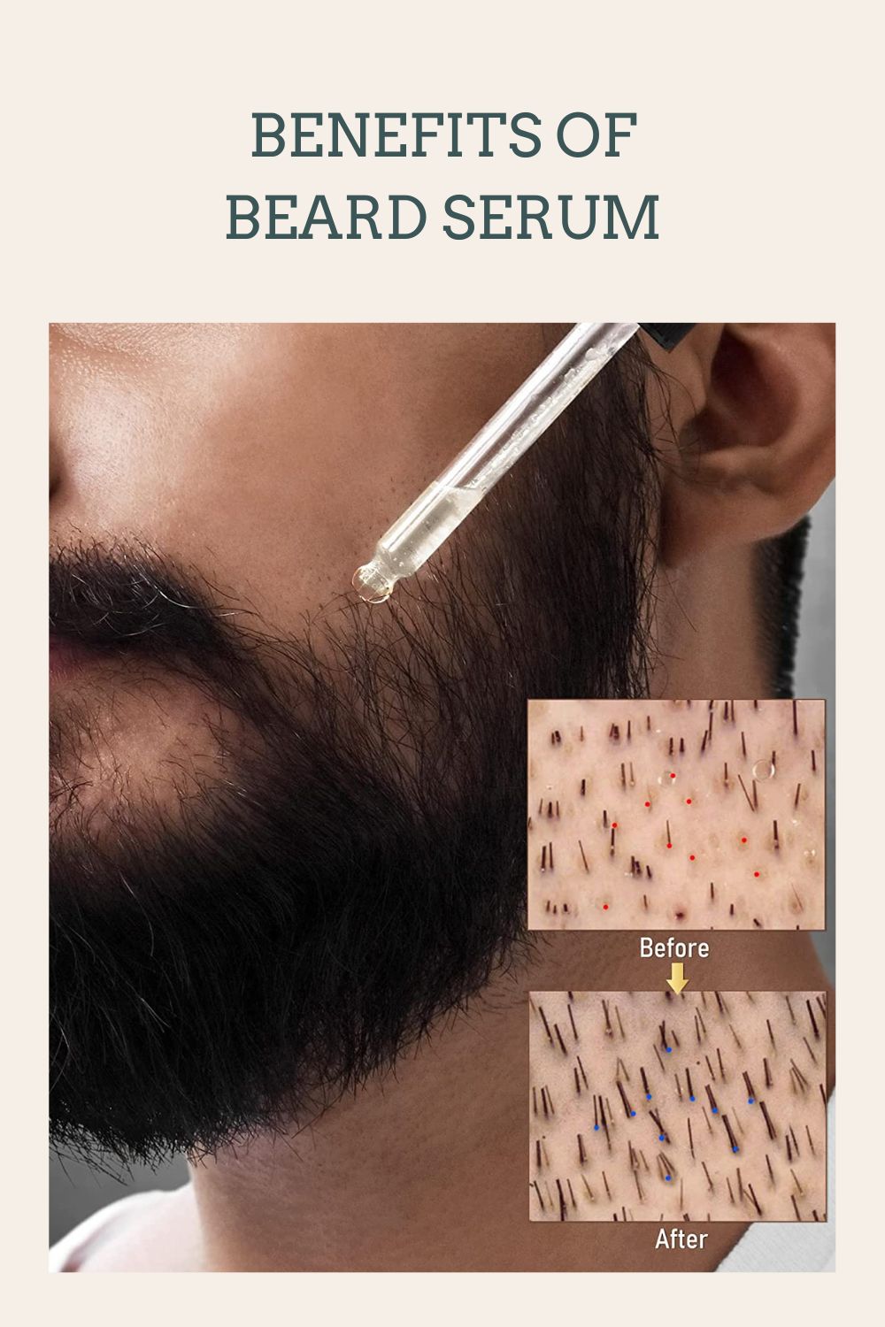 Beard Serum: Uses, Benefits, And Side Effects